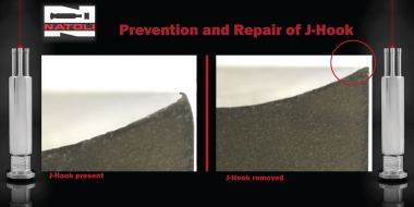 Prevention and Repair of J-Hook